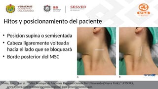 Bloqueo cervical superficial ECOGUIADO.pptx