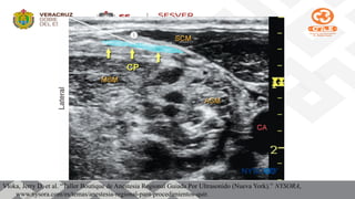 Bloqueo cervical superficial ECOGUIADO.pptx