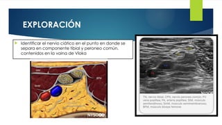 BLOQUEO DE NERVIO FEMORAL Y CIATICO.pptx
