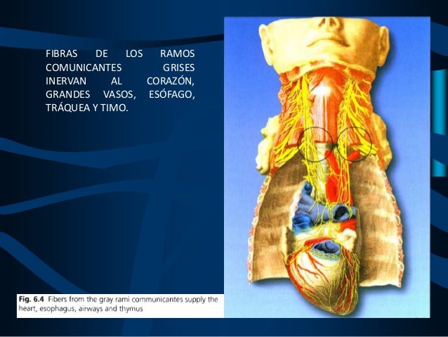 Bloqueo ganglio estrellado