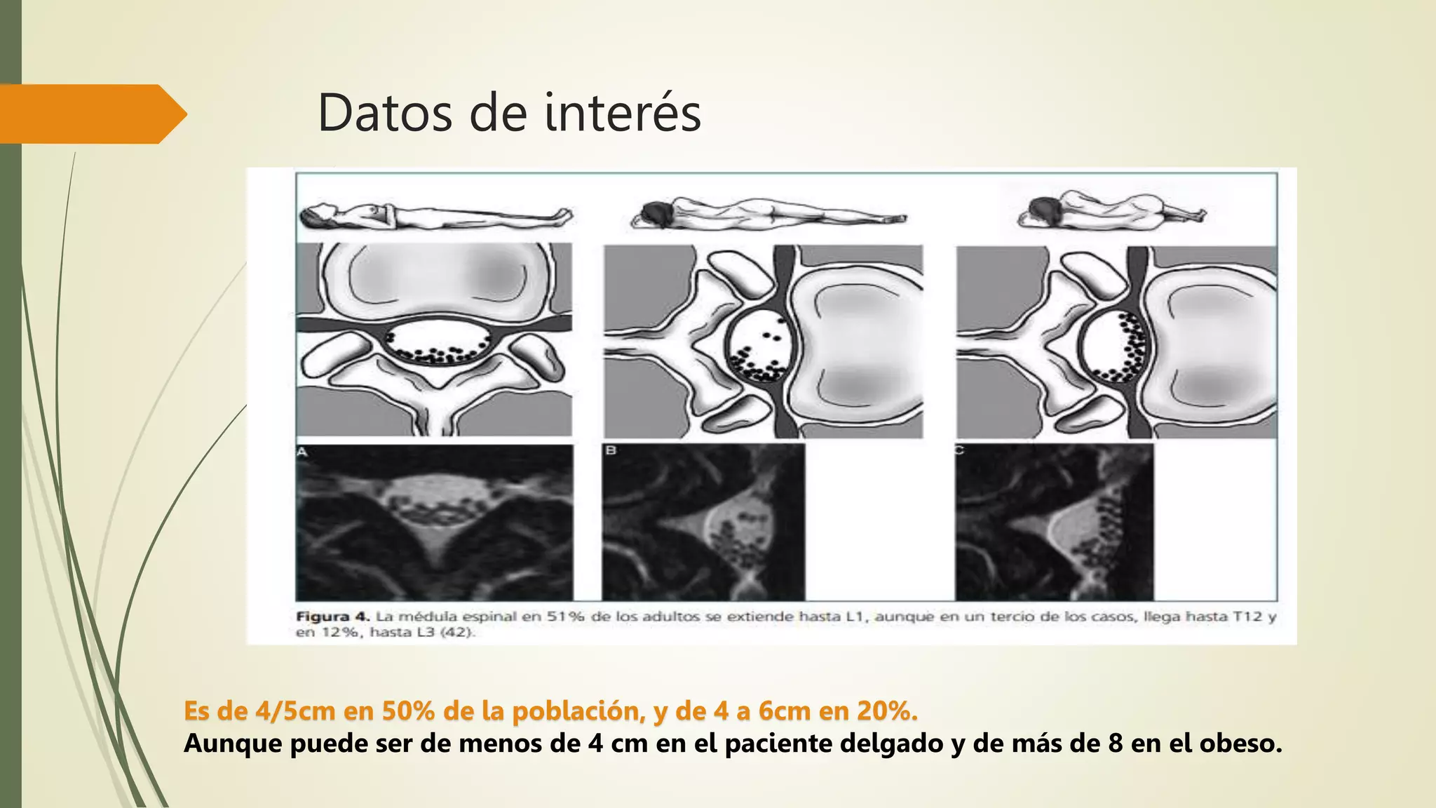 BLOQUEO NEUROAXIAL.pptx