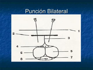 Bloqueo peneano y espinal en pediatria | PPT