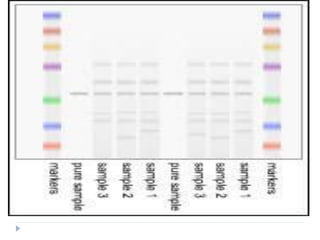 BLOTTING TECHNIQUES (1).pdf