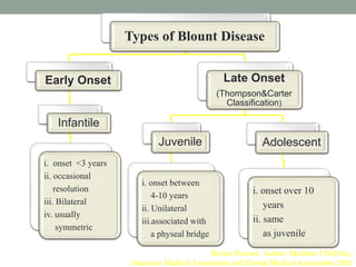 Blount disease | PPTX