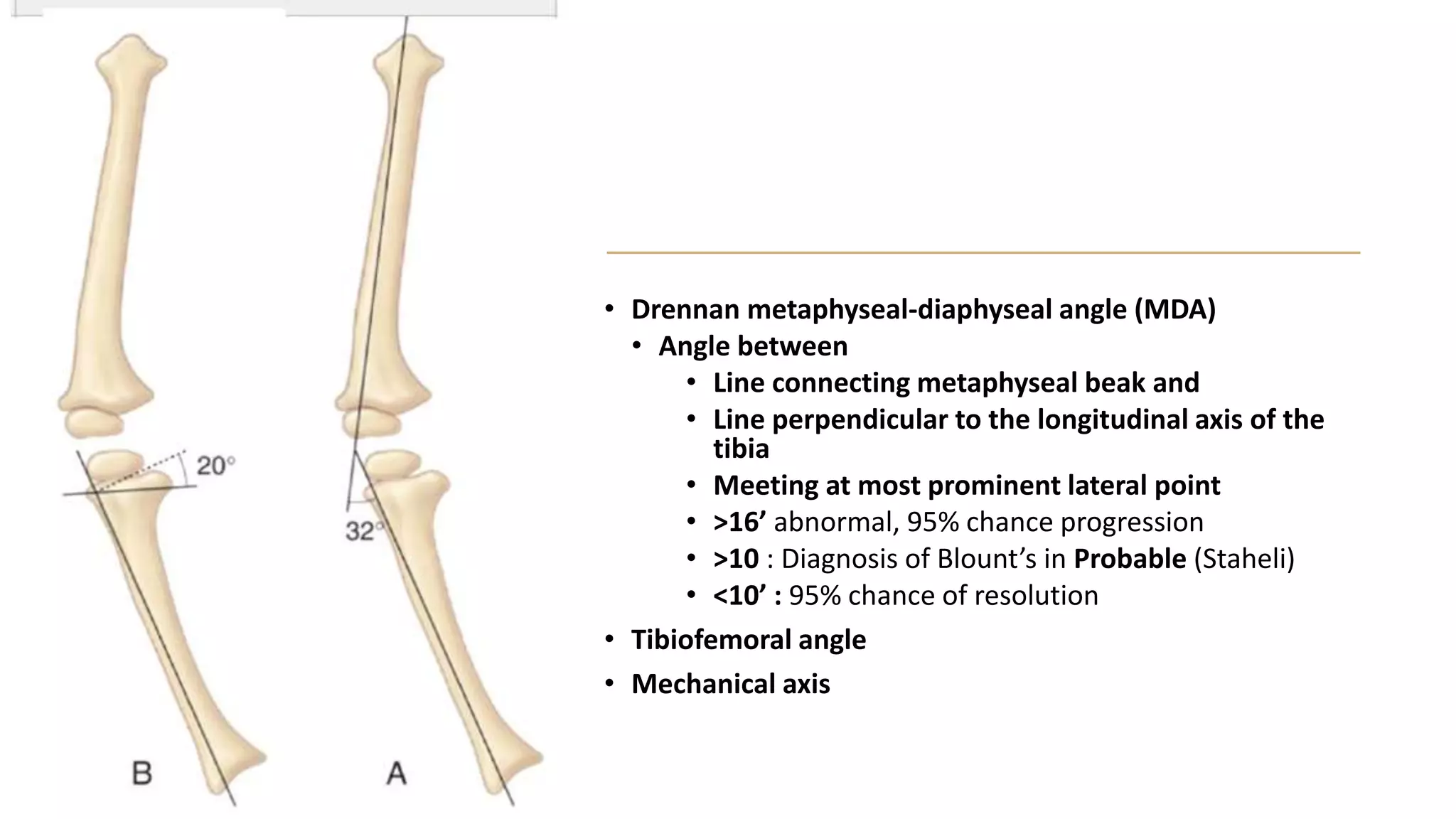 blount disease pptx | PPTX
