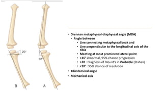 blount disease pptx | PPTX