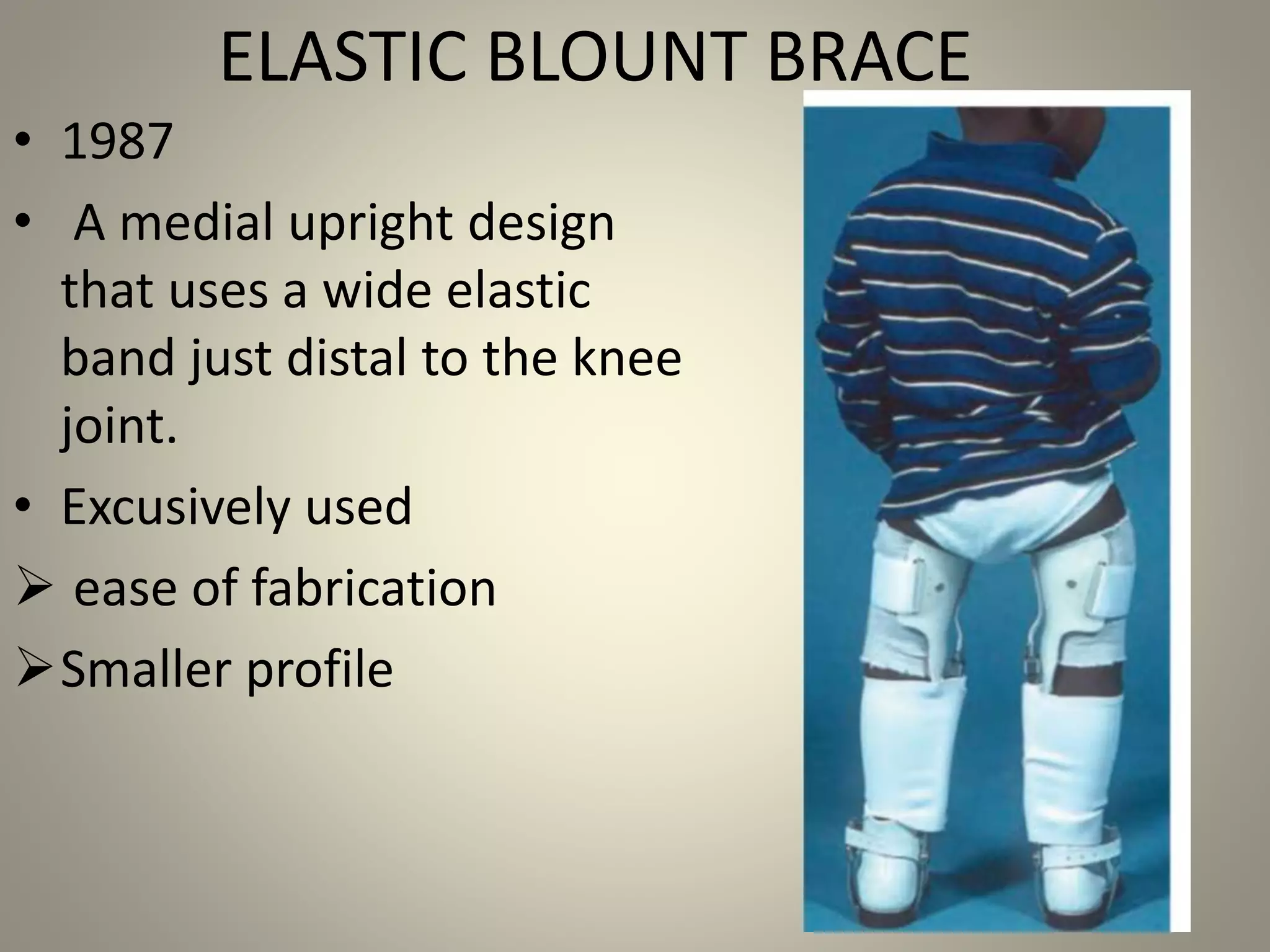 Blounts disease | PPTX