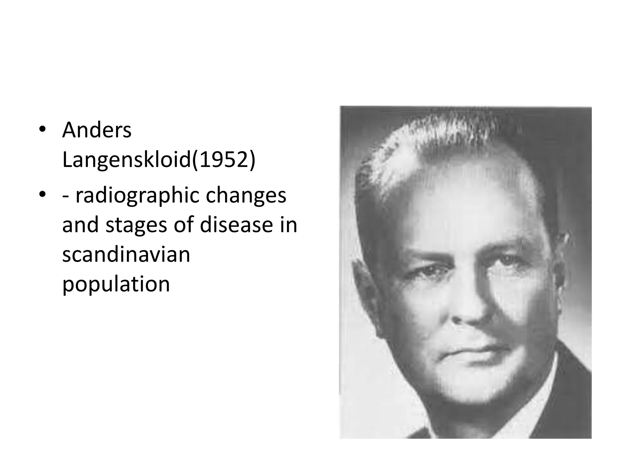 blounts disease.pptx