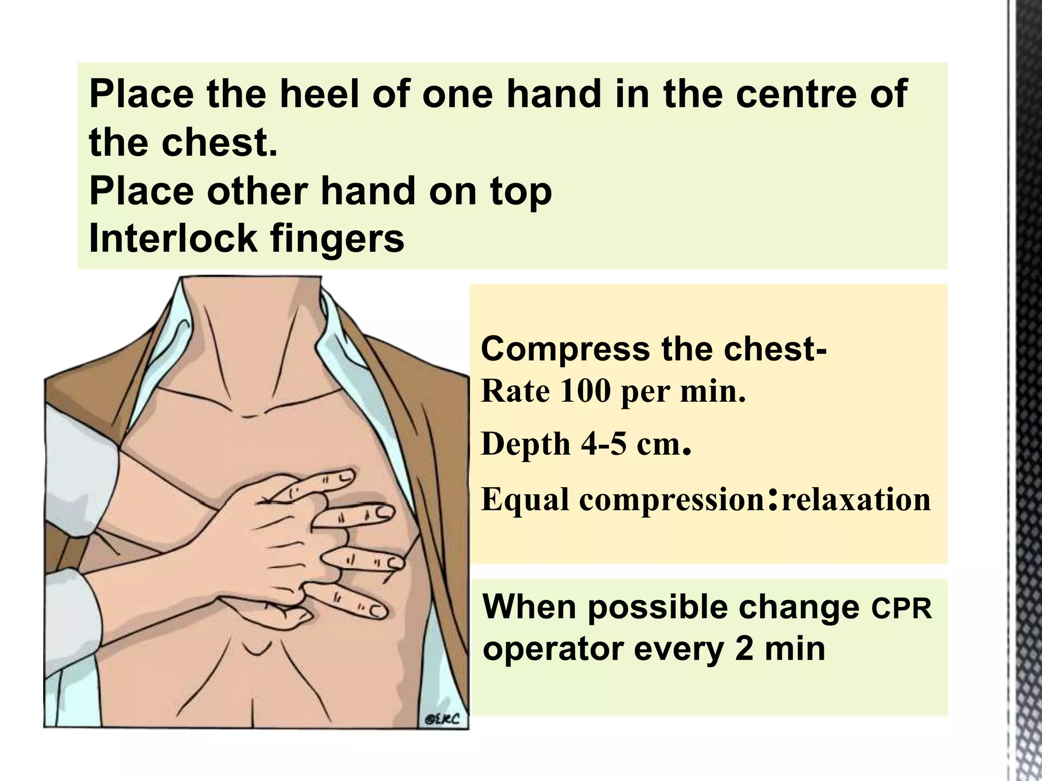 Basic life support,Cardi0-pulmonary resuscitation | PPTX