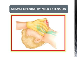 Basic life support,Cardi0-pulmonary resuscitation | PPTX