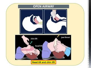 Basic life support,Cardi0-pulmonary resuscitation | PPTX