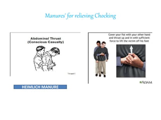 Basic life support | PPT