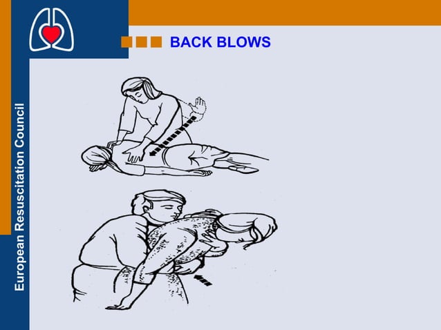 BASIC LIFE SUPPORT | PPT | First Aid | Injuries
