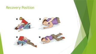 Basic life support at ed and how to handle choking | PPTX