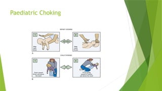 Basic life support at ed and how to handle choking | PPTX