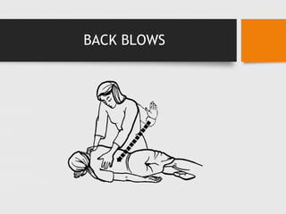 Basic life support | PPTX