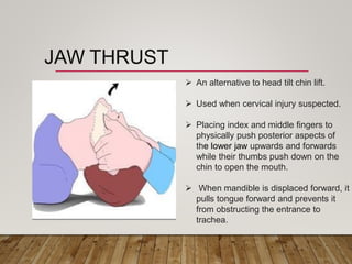 Basic Life Support (BLS) | PPT