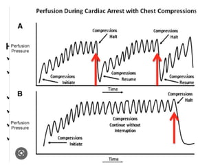 Basic life support- a beginners tutorial | PPTX