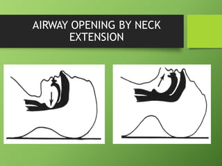 BASIC LIFE SUPPORT - DR. ANVITA BHARGAVA | PPTX