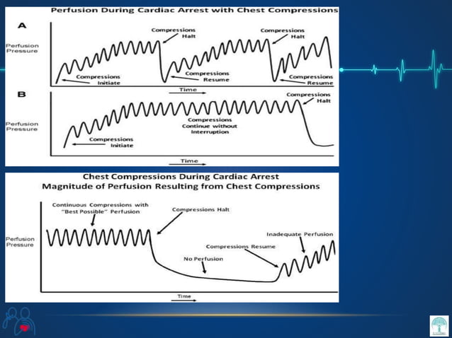 CPR , Basic Life Support 2020 | PPTX