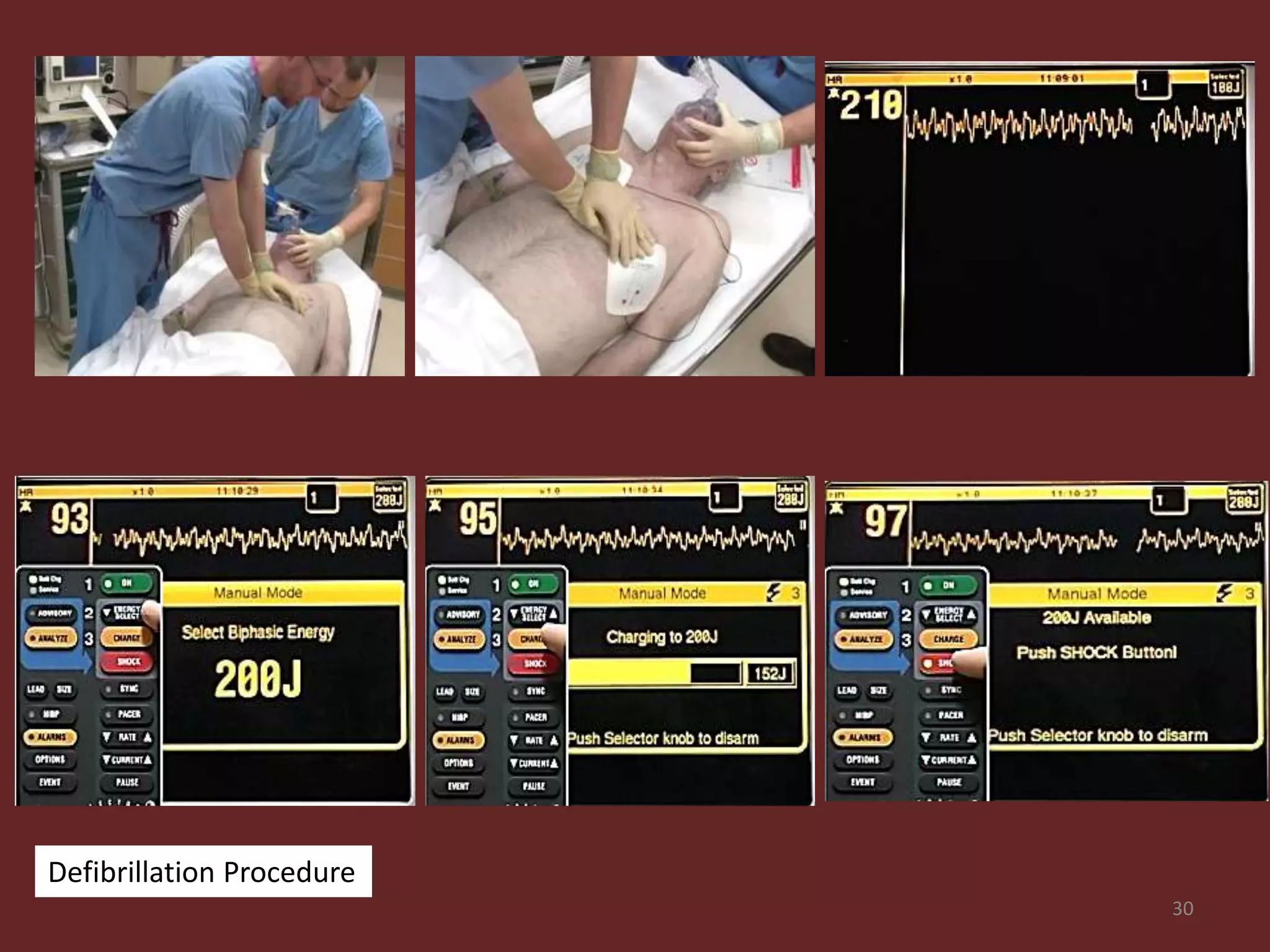 BLS ACLS.pptx | First Aid | Injuries