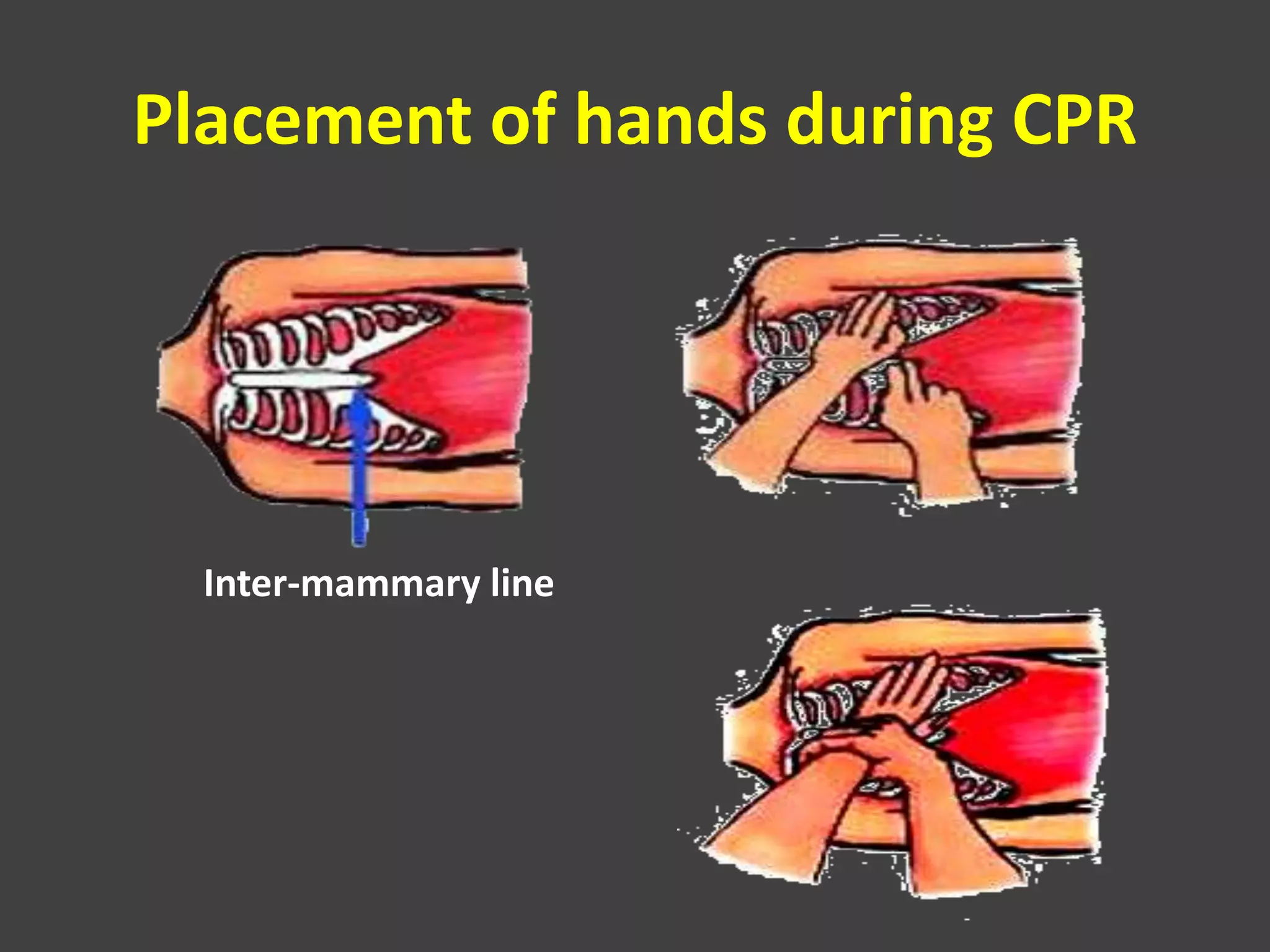 BLS & ACLS.pptx