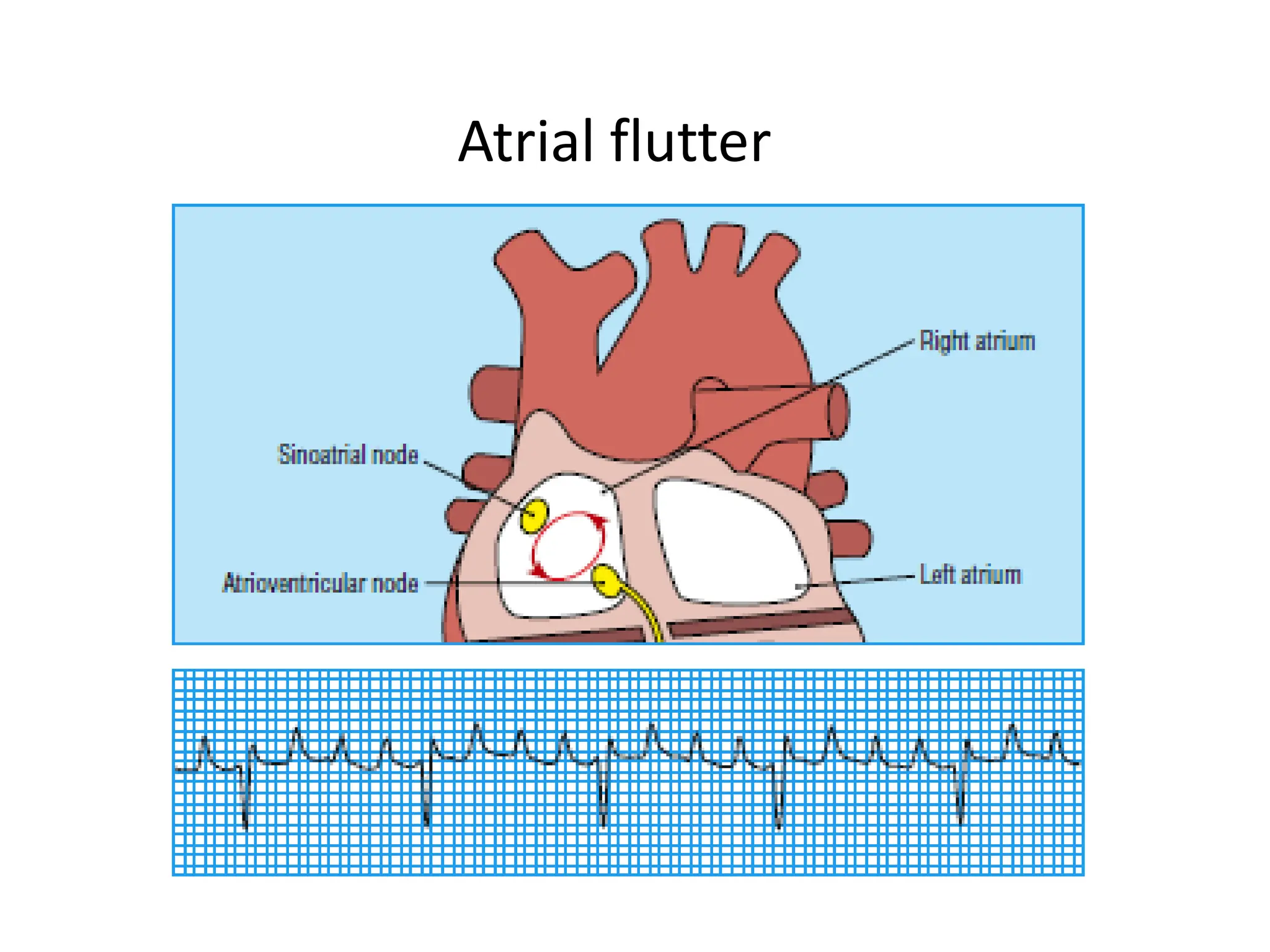 BLS and ACLS Basics of life support.pptx
