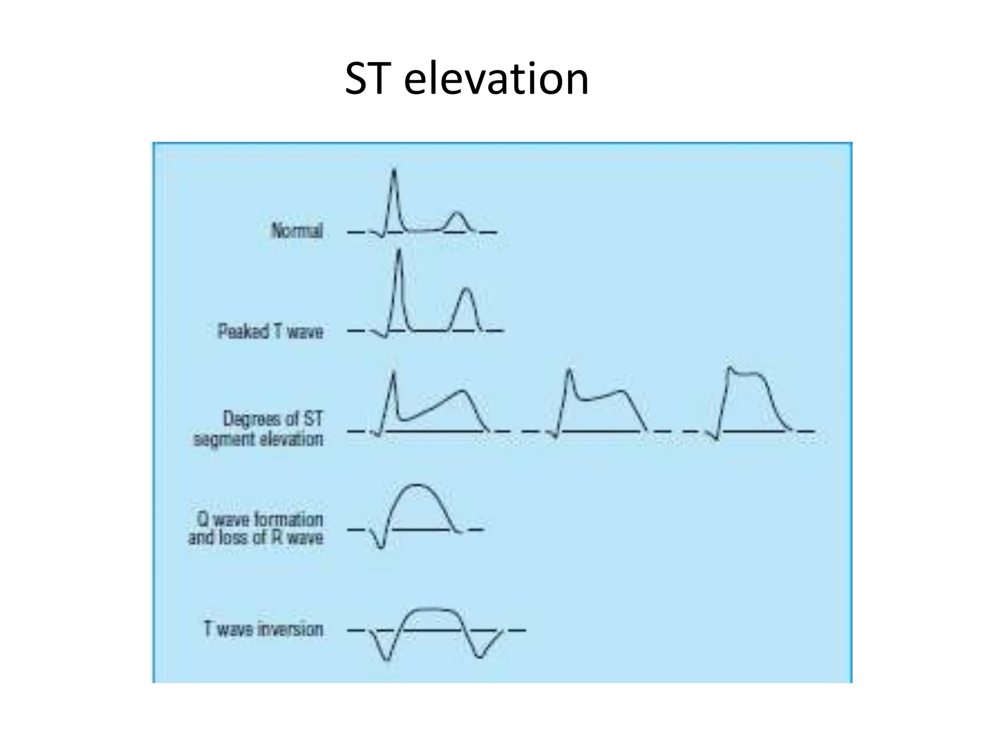 BLS and ACLS Basics of life support.pptx