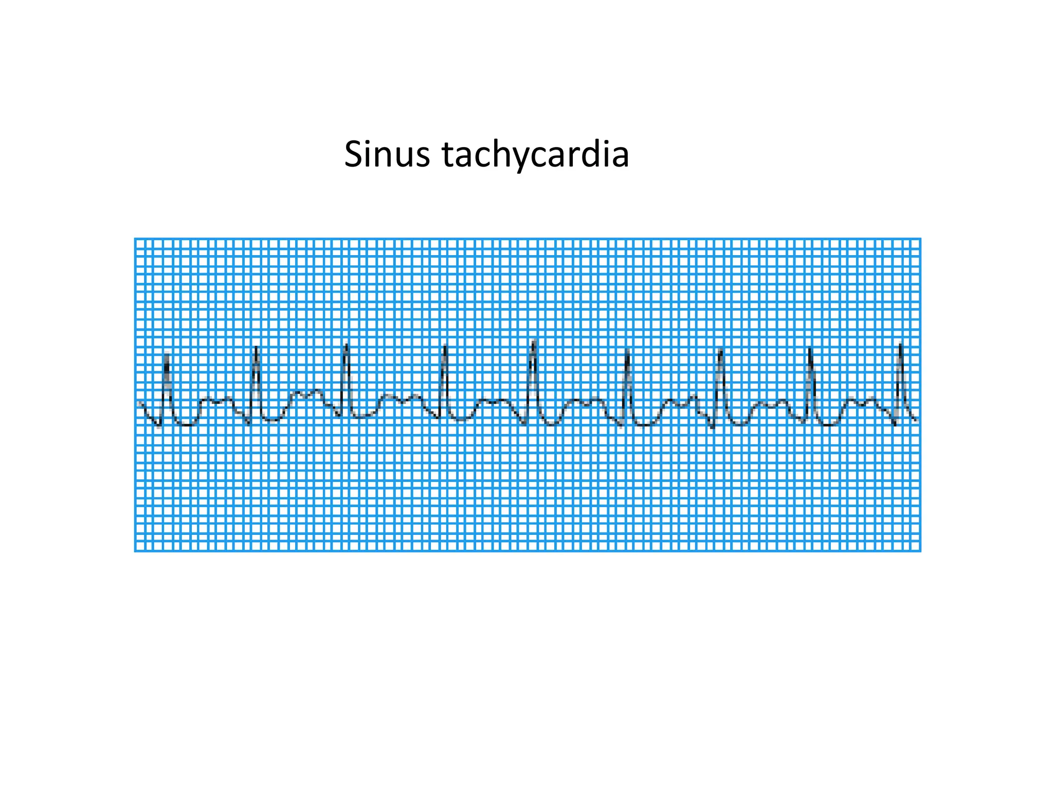 BLS and ACLS Basics of life support.pptx