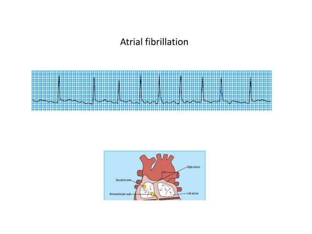 BLS and ACLS Basics of life support.pptx