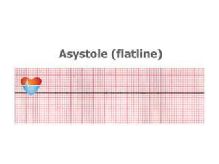 BLS and ACLS Basics of life support.pptx