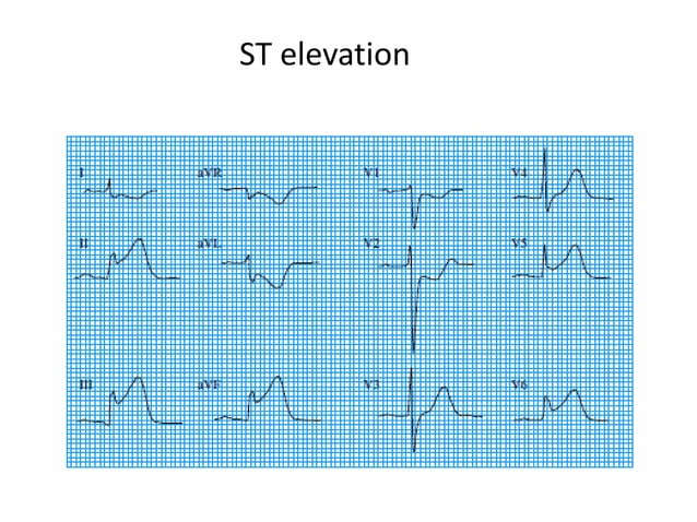 BLS and ACLS Basics of life support.pptx