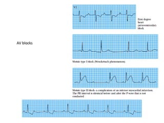 BLS and ACLS Basics of life support.pptx