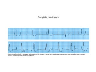 BLS and ACLS Basics of life support.pptx