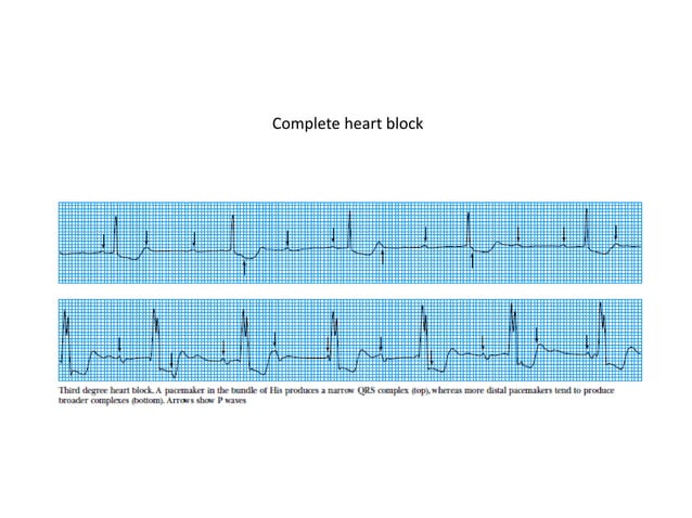 BLS and ACLS Basics of life support.pptx