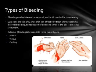 Bls care for bleeding and shock | PPTX