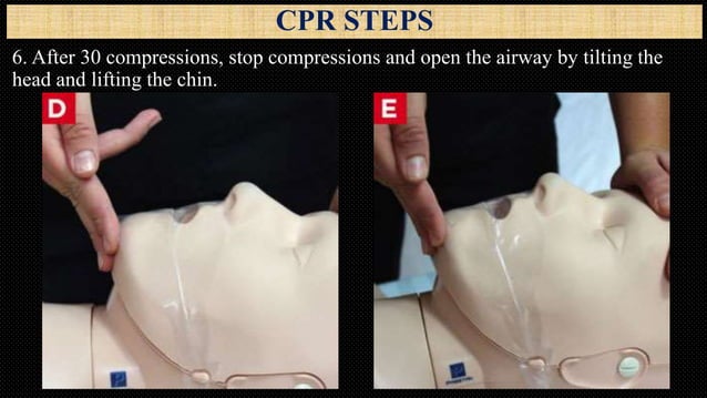 BLS CHILD.pptx | First Aid | Injuries