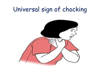 BLS chocking (1).pptx