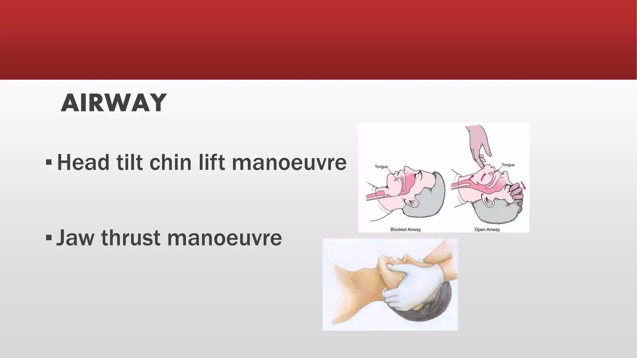BASIC LIFE SUPPORT BLS & CPR | PPTX