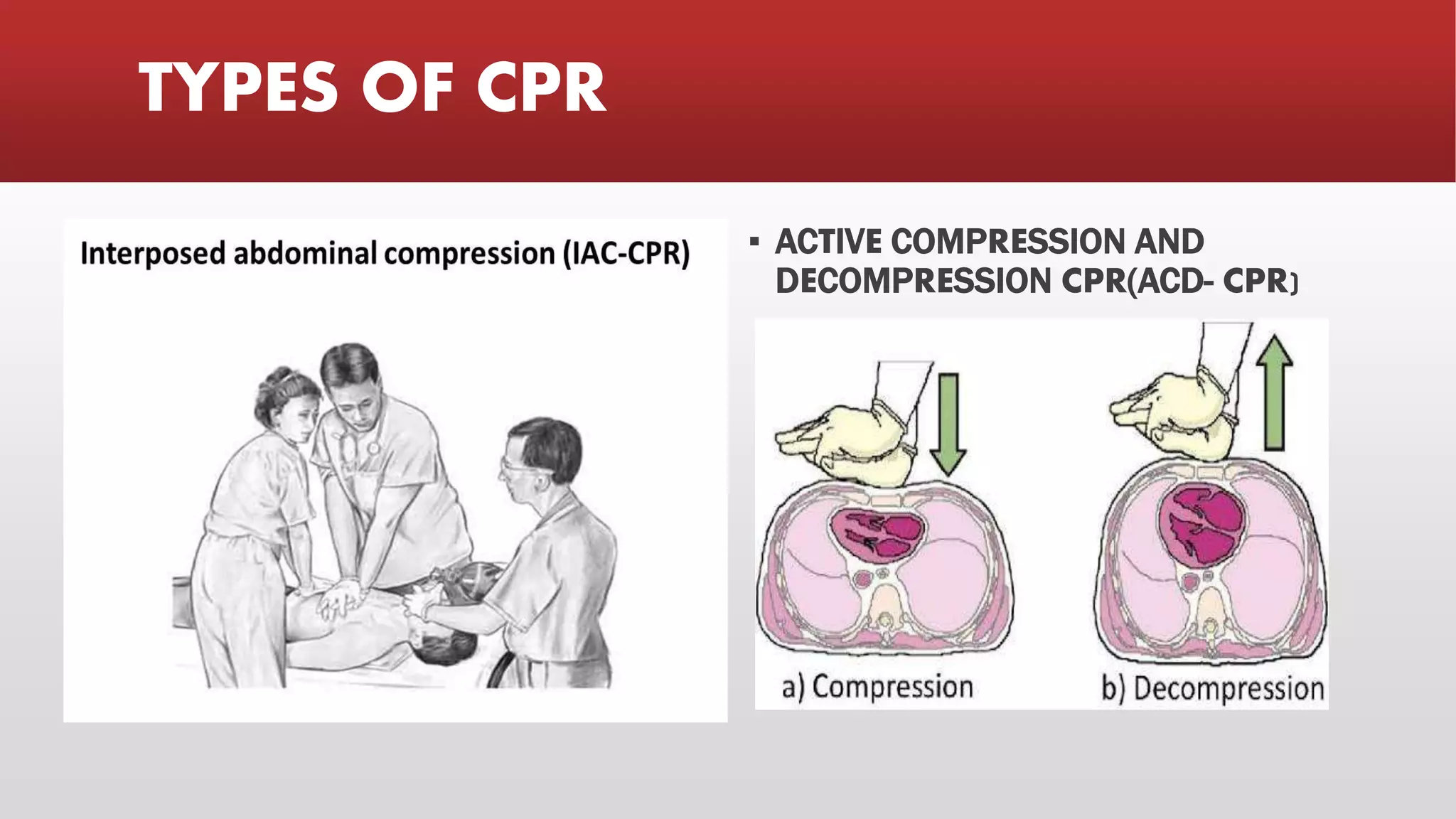 BASIC LIFE SUPPORT BLS & CPR | PPTX
