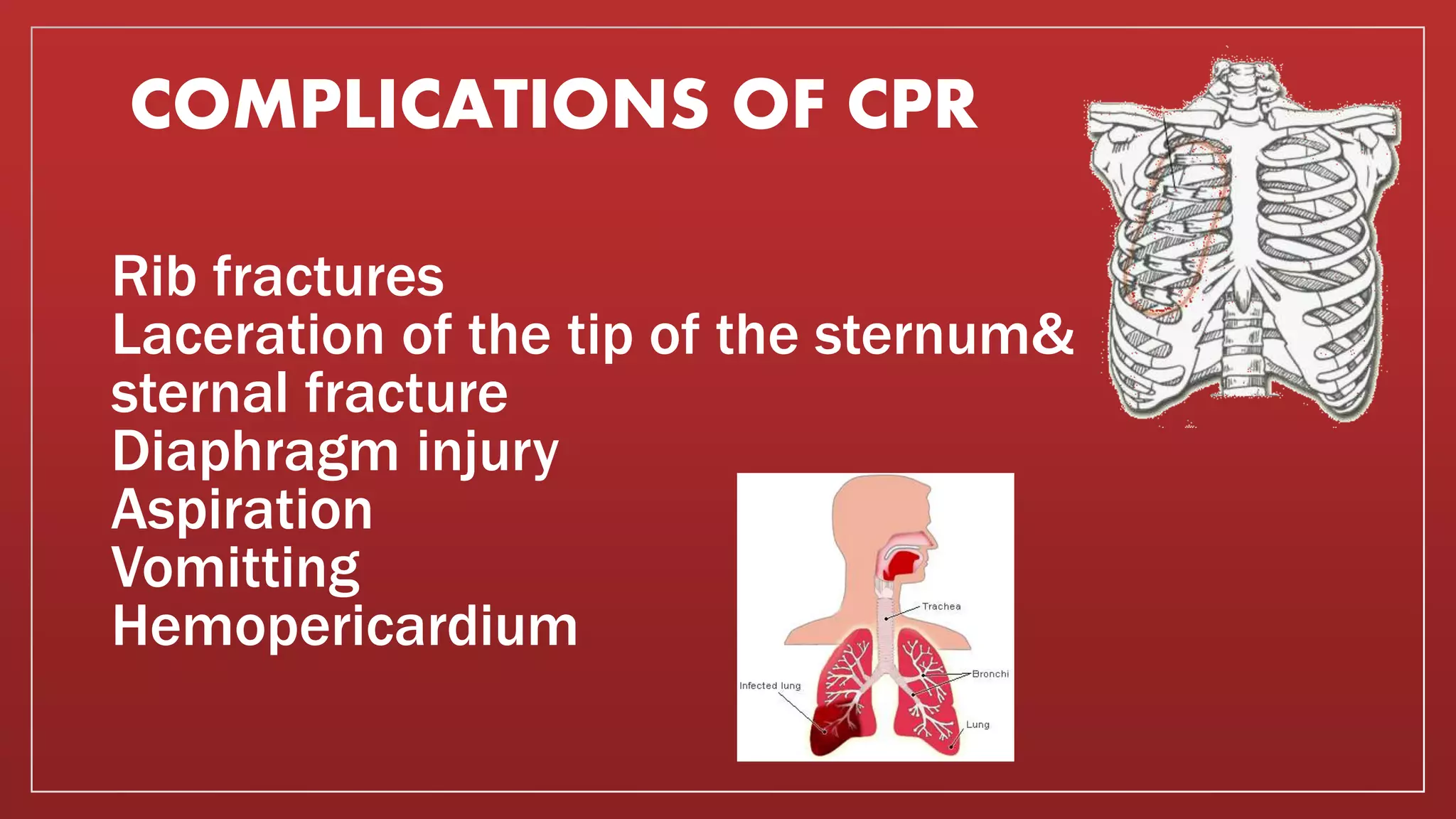 BASIC LIFE SUPPORT BLS & CPR | PPTX