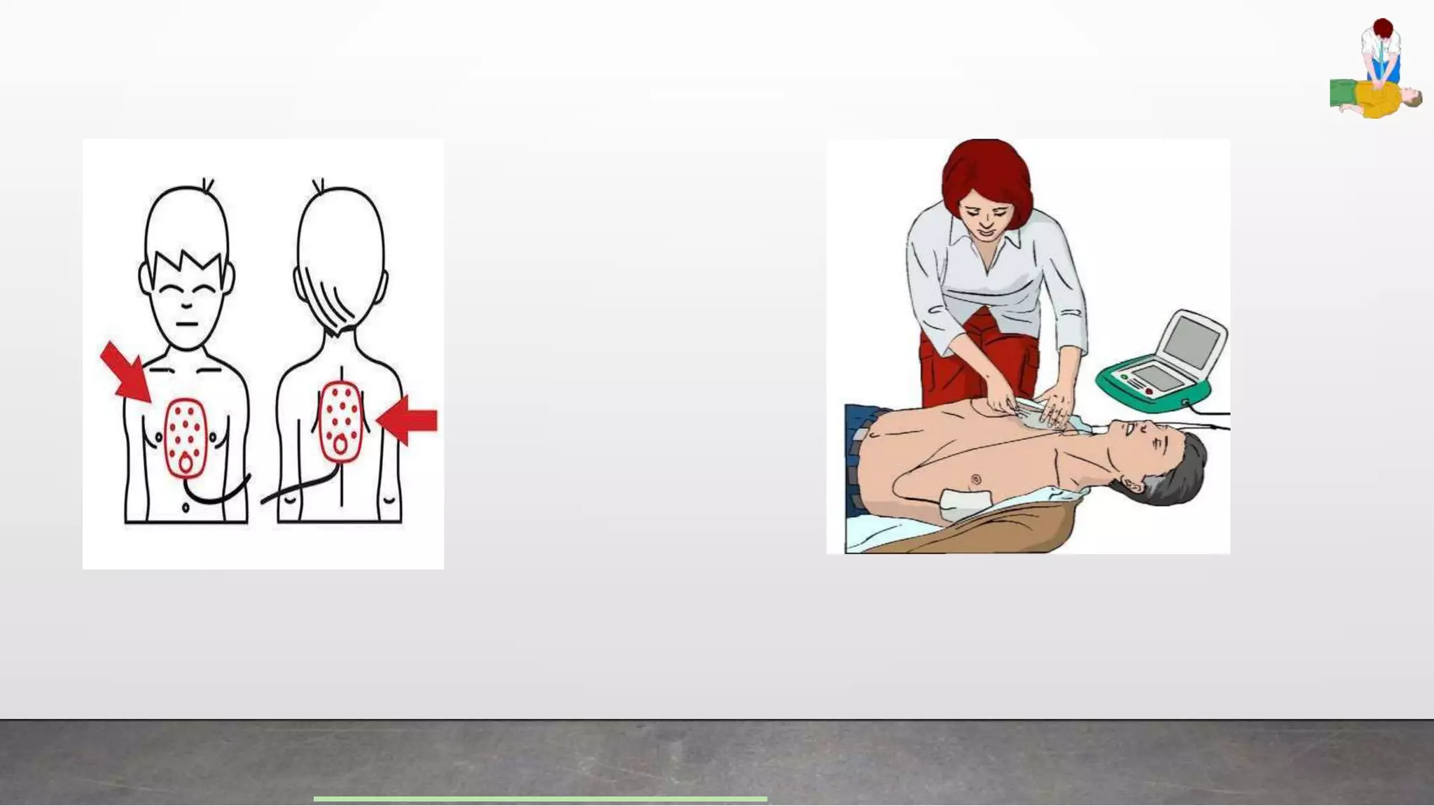 Basic life support | PPTX