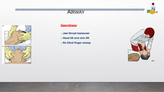 Basic life support | PPTX