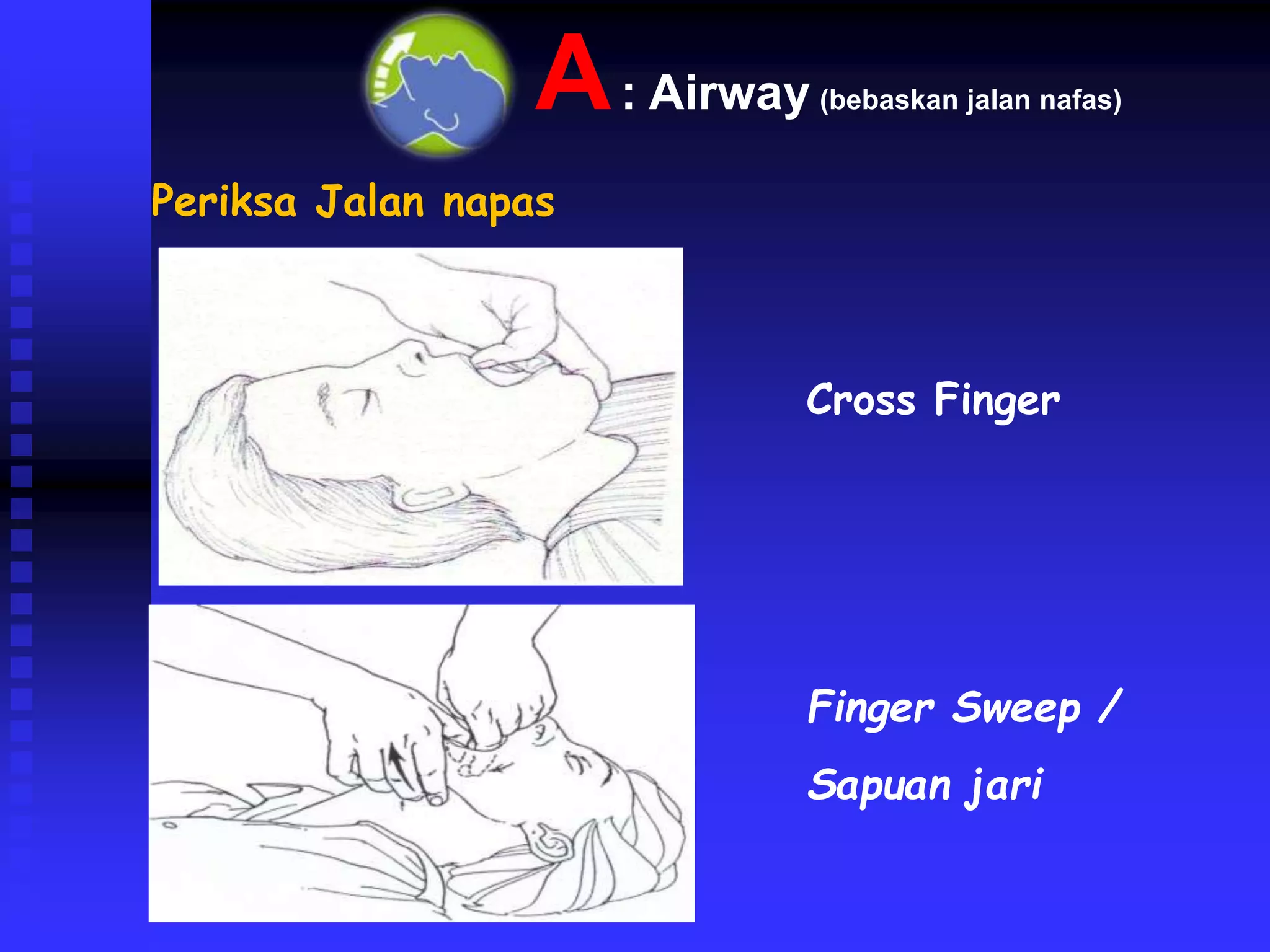 Bantuan Hidup Dasar (2015 AHA Guideline) | PPTX