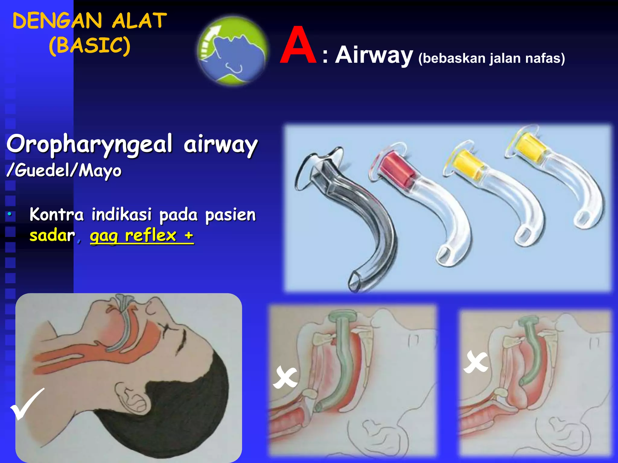 Bantuan Hidup Dasar (2015 AHA Guideline) | PPTX