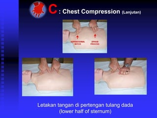 Bantuan Hidup Dasar (2015 AHA Guideline) | PPTX