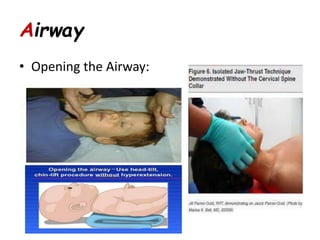 Pediatric Bls for nurses | PPTX