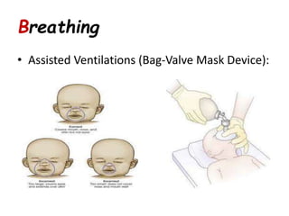 Pediatric Bls for nurses | PPTX