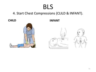 Pediatric Bls for nurses | PPTX