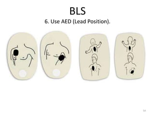 Pediatric Bls for nurses | PPTX